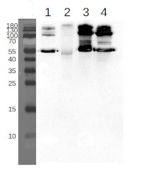 Anti-SHMT1 | Serine hydroxymethyltransferase 1, mitochondrial antibodies