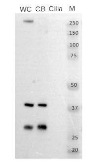 Anti-NAB1 | nucleic acid binding protein 1, Chlamydomonas antibodies
