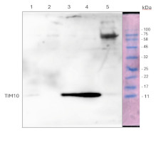 Anti-TIM10| Mitochondrial import inner membrane translocase subunit ...