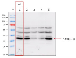Anti-PDHE1-B | Pyruvate dehydrogenase E1 component subunit beta-1 ...