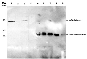 Anti-ABA2 | ABA deficient 2 antibodies