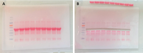 Ponceau Staining Pvdf Membrane Protocol - Infoupdate.org