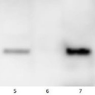 Anti-Toc75 | Protein TOC75-3, chloroplastic, POTRA domain 3 antibodies